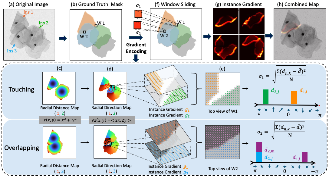 Gains Gradient Anomaly Aware Biomedical Instance Segmentation