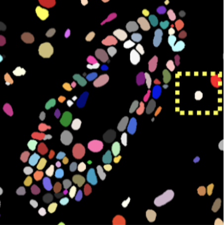 CIA-Net: Robust Nuclei Instance Segmentation with Contour-Aware Information Aggregation ...